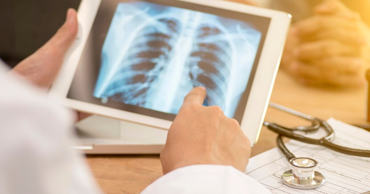 Deze dodelijke infectieziekte is in Nederland het afgelopen jaar licht ...
