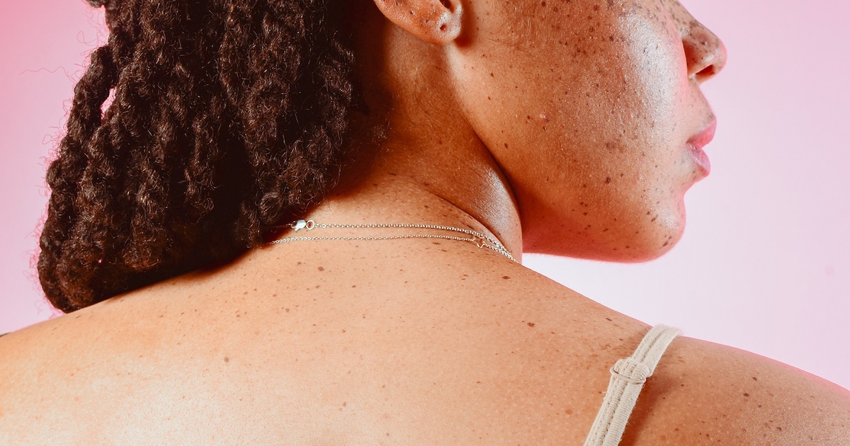 Wrat weghalen: hoe kun je dat het beste aanpakken | Margriet | Margriet