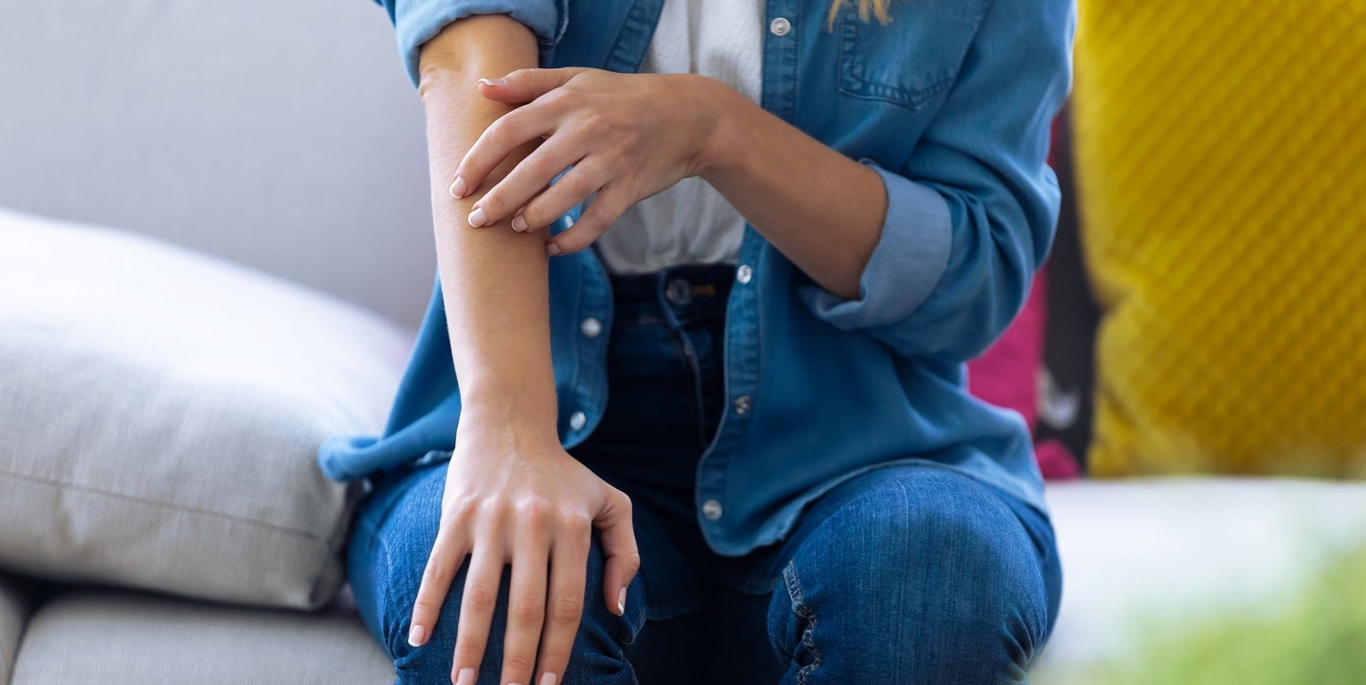 Dít is het verschil tussen netelroos en gordelroos | Margriet