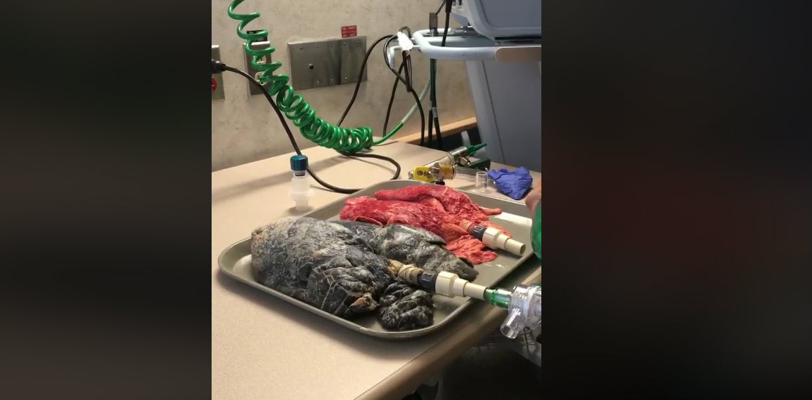 Video: dit kan óók met je longen gebeuren als je rookt | Margriet