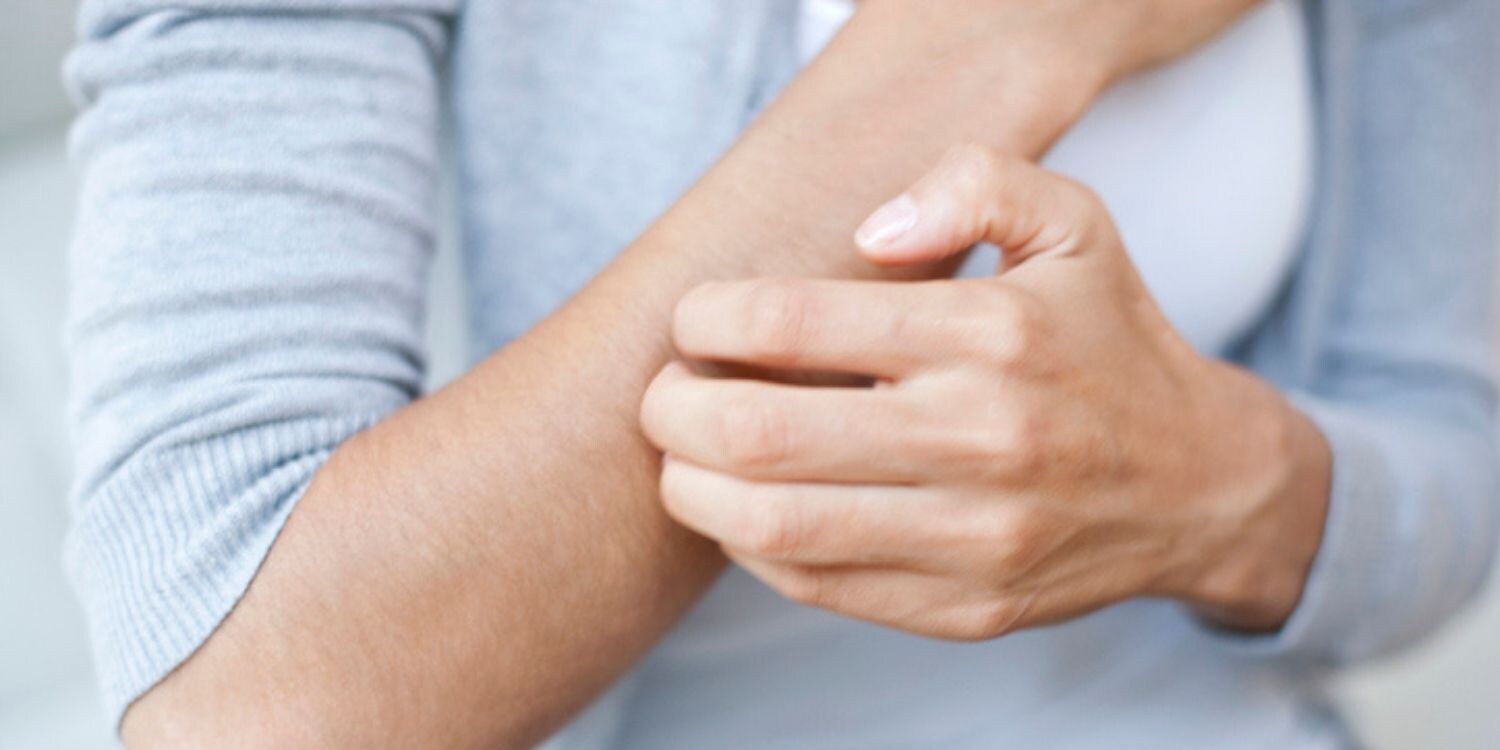 Verschillen tussen muggenbult en processierups-bult | Margriet | Margriet