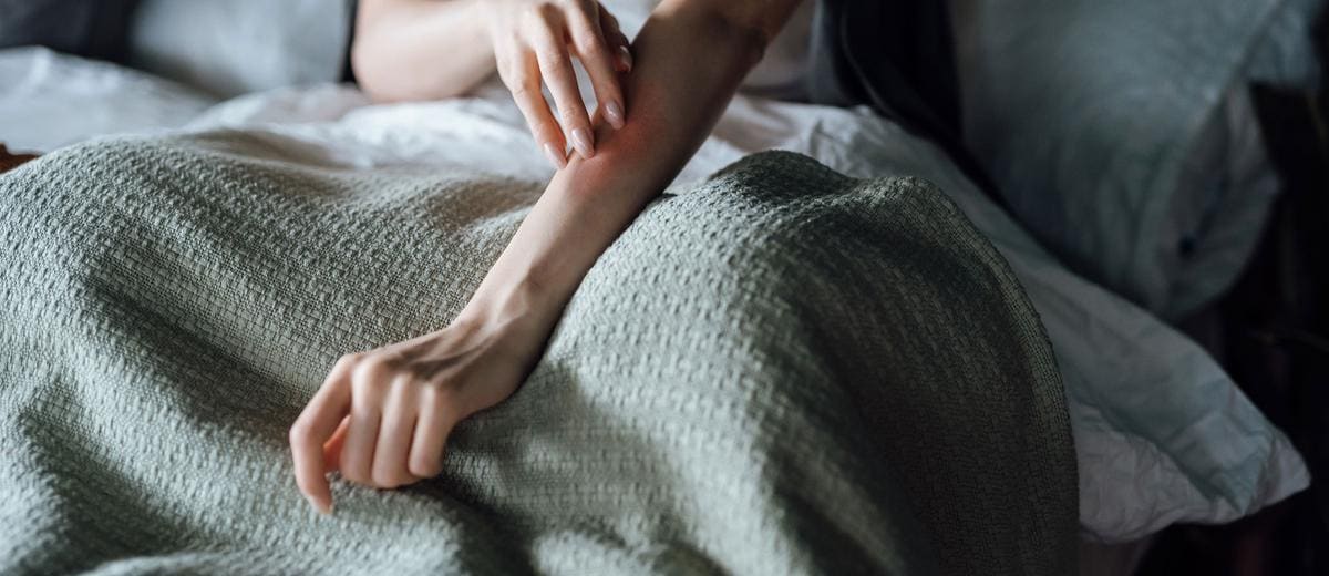 Zo herken je een spinnenbeet (en dít is wanneer je naar de dokter moet ...