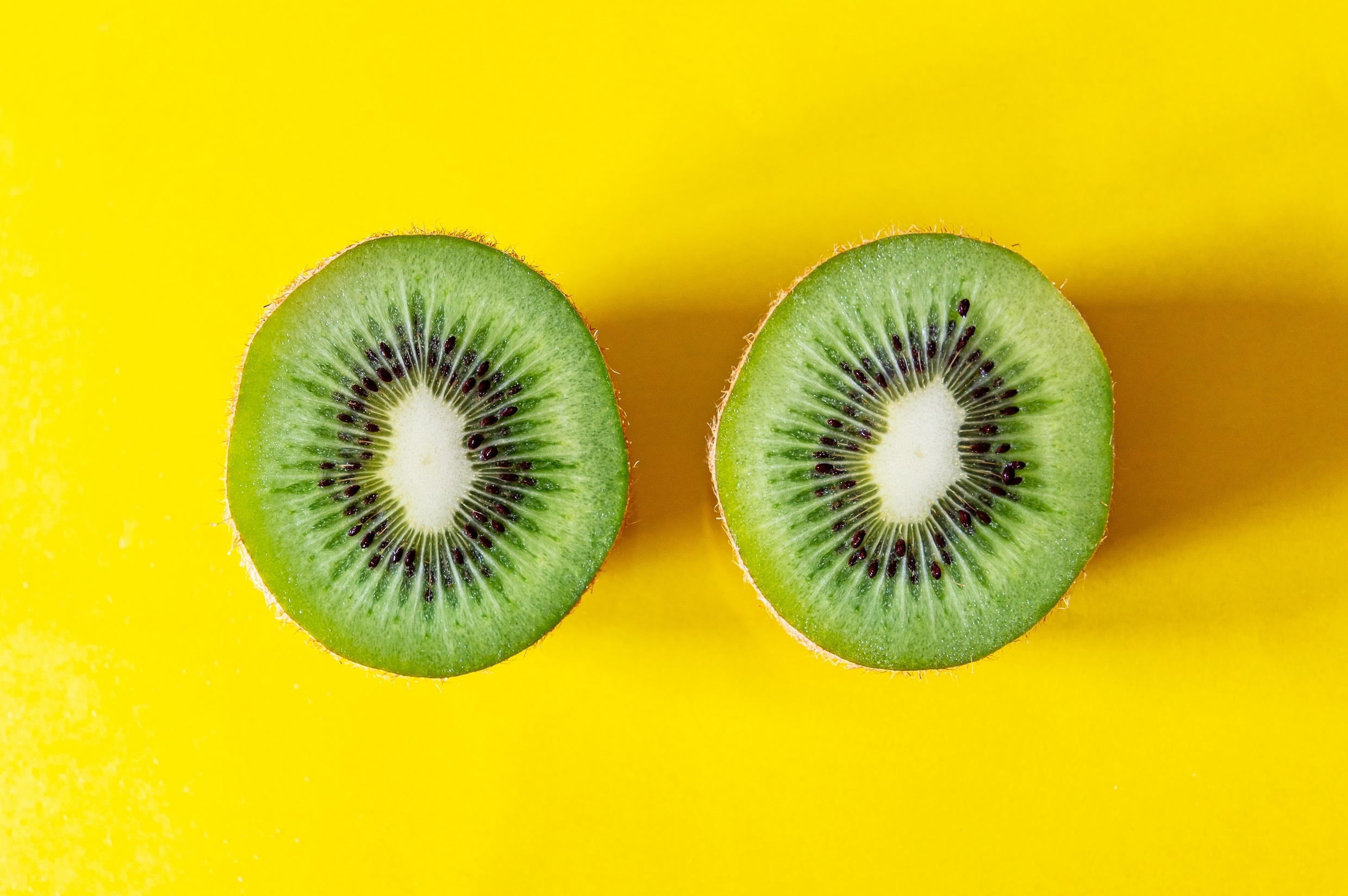 Groene of gele: deze kiwi's zijn het gezondst | Margriet