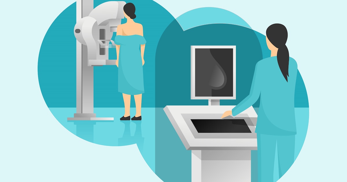 Mammogram kan bij knobbeltje in borst vervangen worden door een echo | Margriet