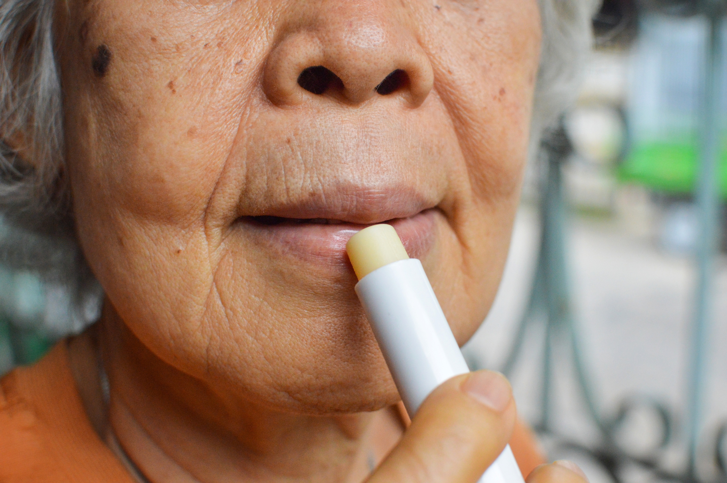 4 vragen aan een dermatoloog over droge lippen en lippenbalsem | Margriet