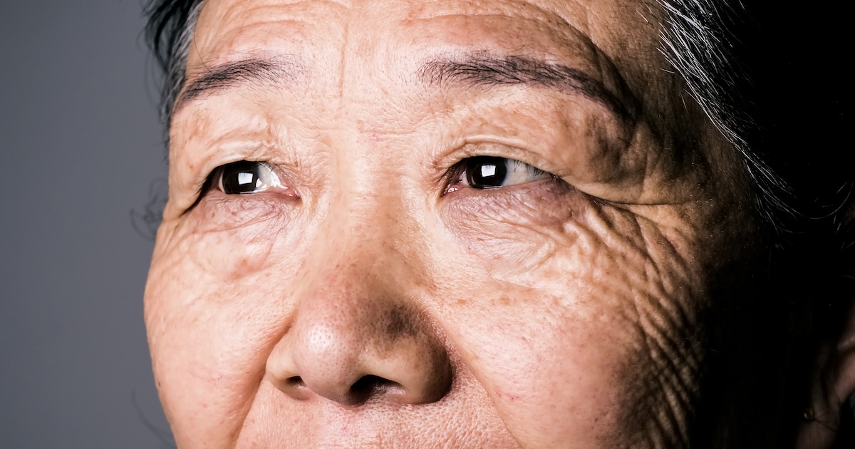 Oogtrombose: symptomen, oorzaken en behandeling van trombose in het oog