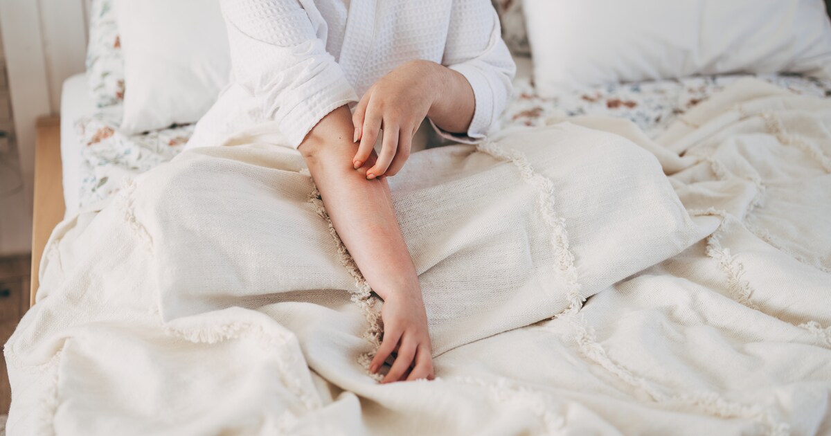 Jeuk van een muggenbult? Dit moet je vooral níét doen | Margriet