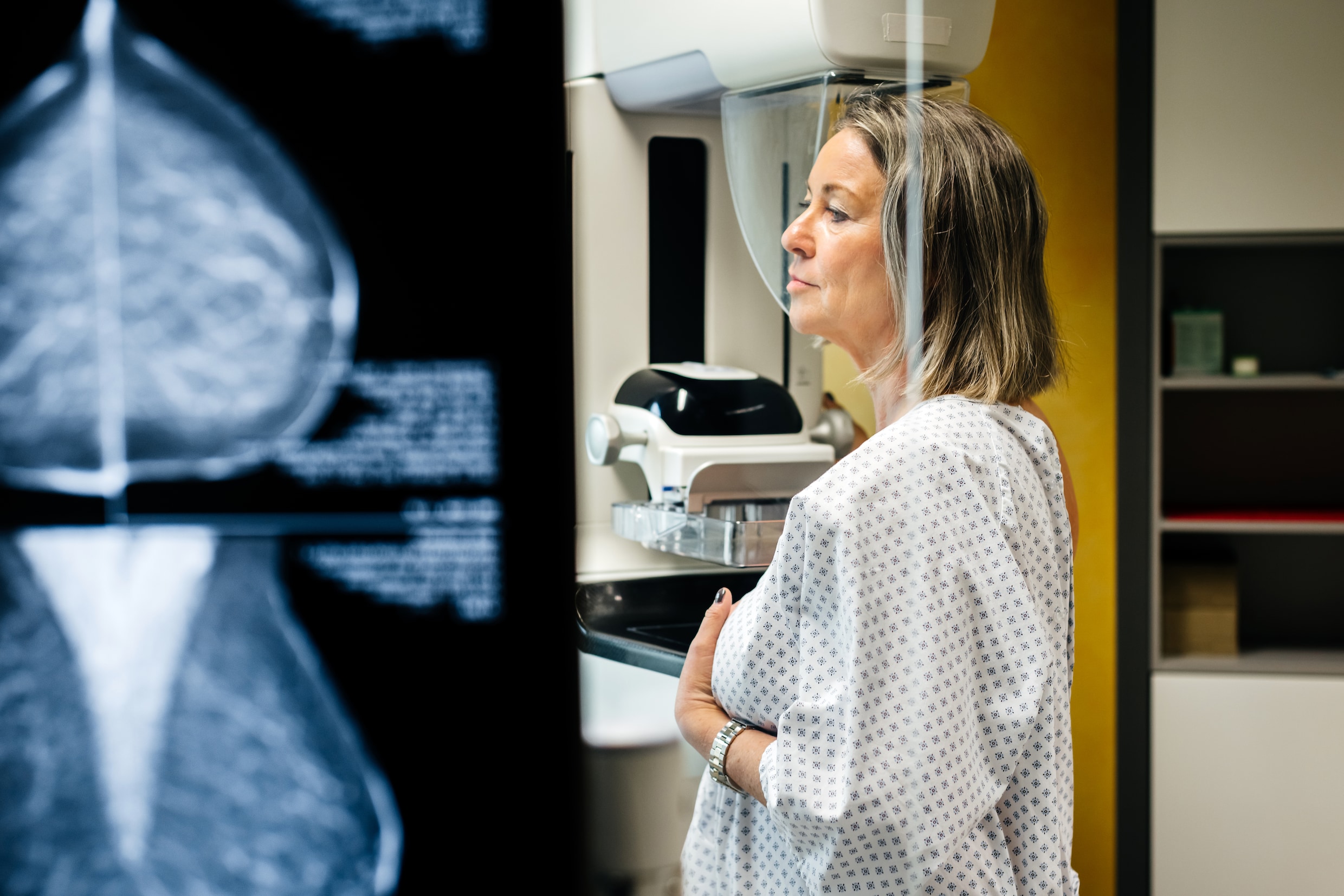 Borstkanker te vaak gemist op mammografie: kabinet gaat in gesprek over verbetering | Margriet
