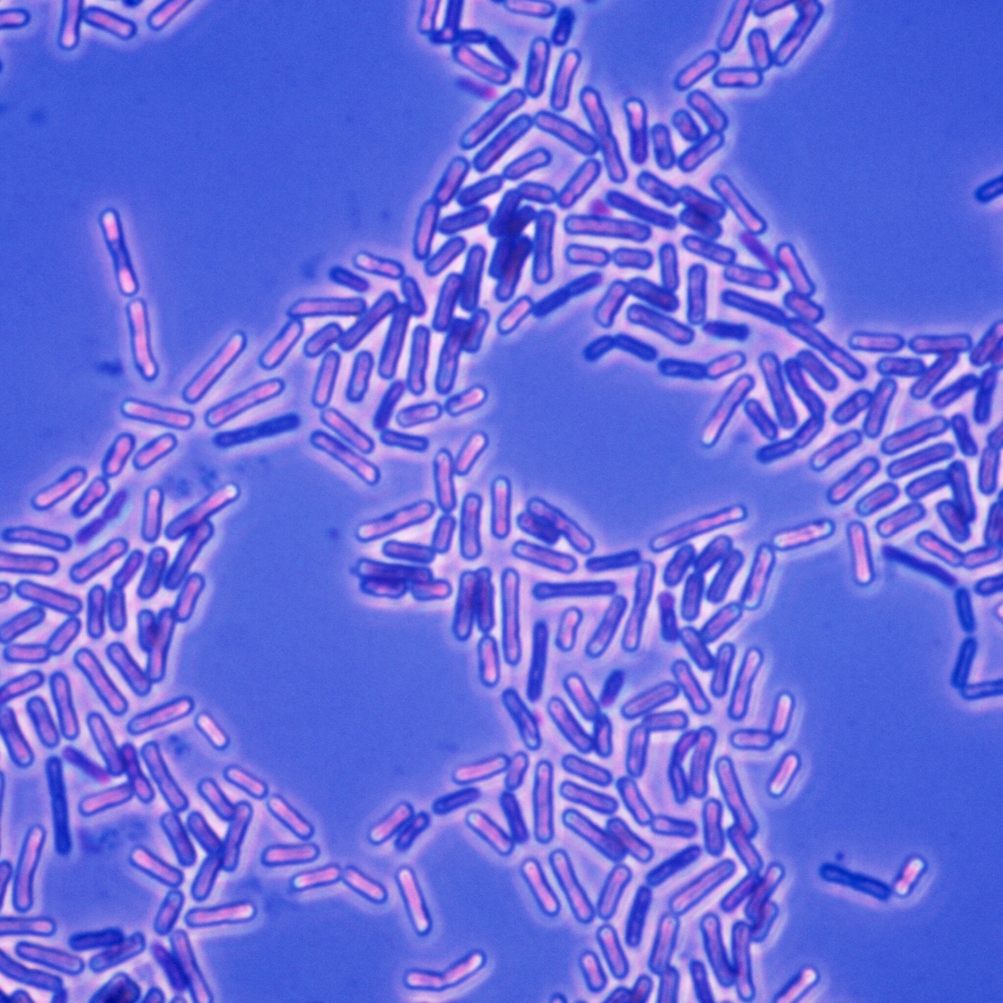 Zo lang doet je lichaam erover om de bacteriën in je darmen te ...