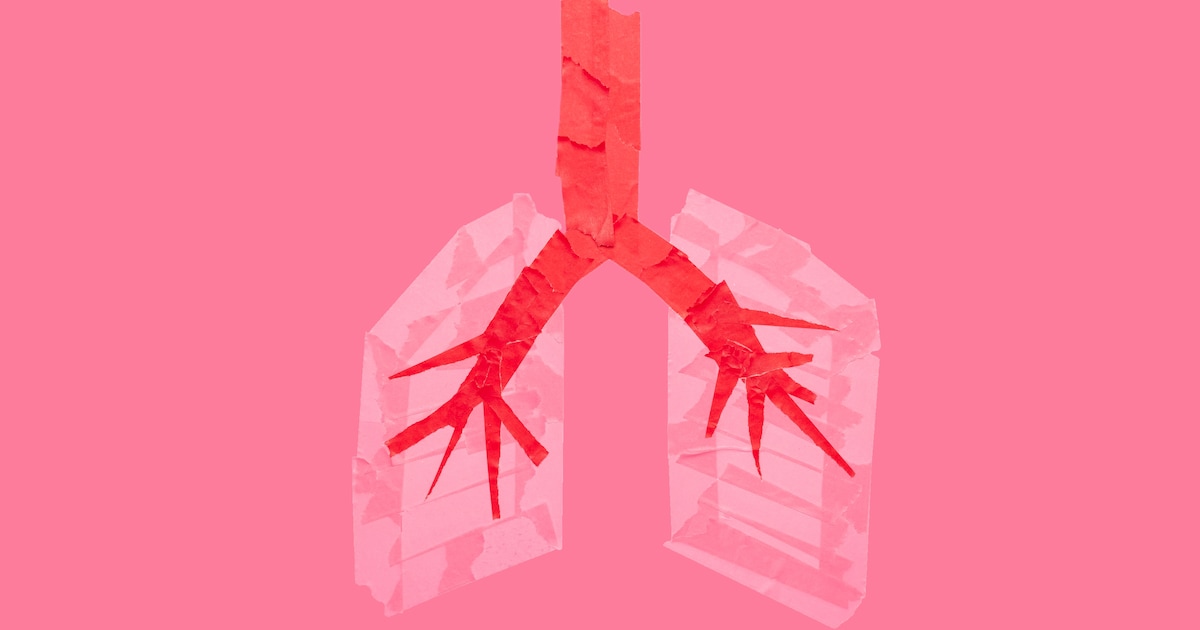 Dit zijn de oorzaken en symptomen van een dubbele longontsteking | Margriet